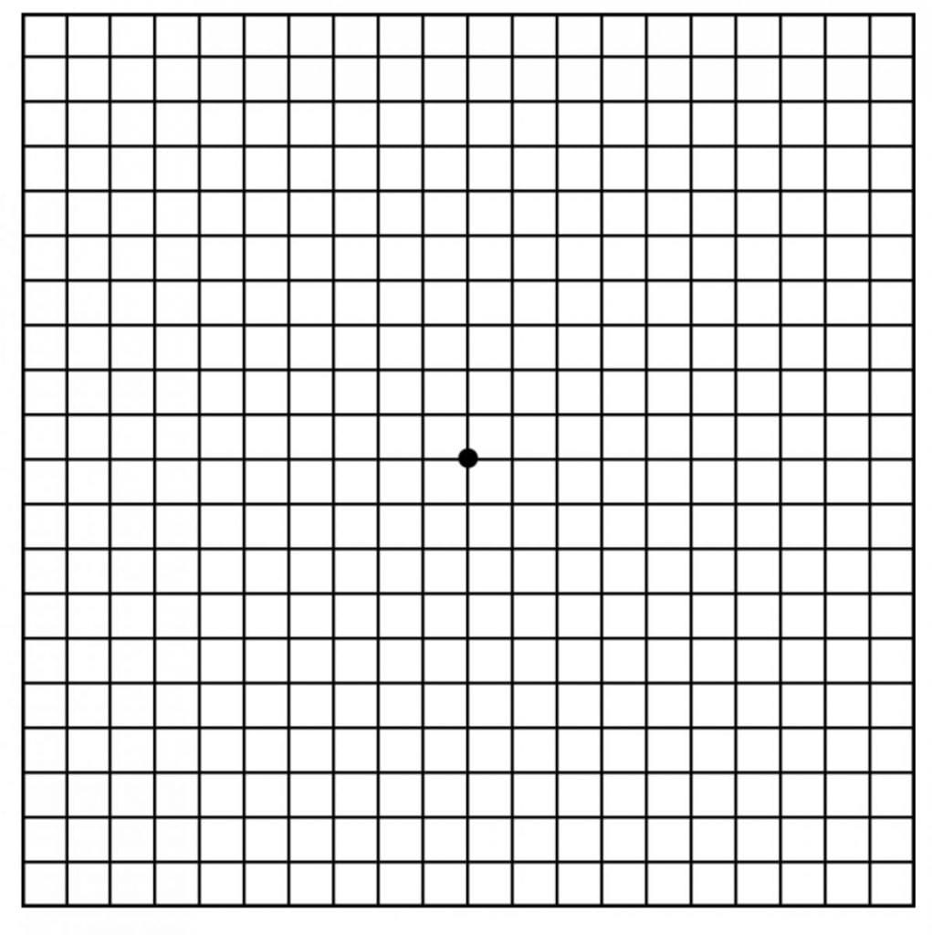 Diagnosing Age related Macular Degeneration AMDF